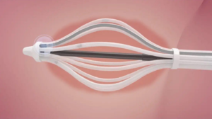 What Are the Differences Between Brachytherapy and EBRT?